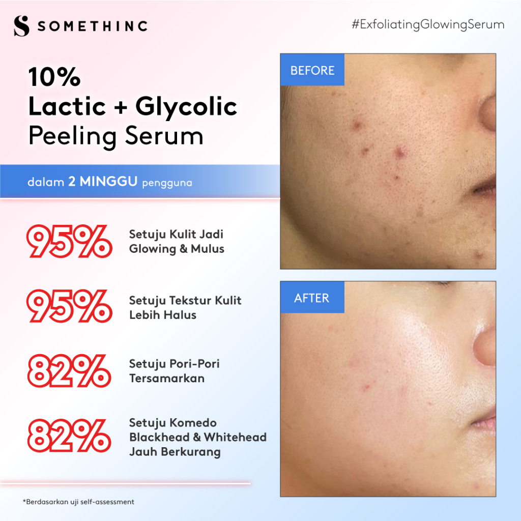 Somethinc 10% Lactic + Glycolic Peeling Serum 20ml